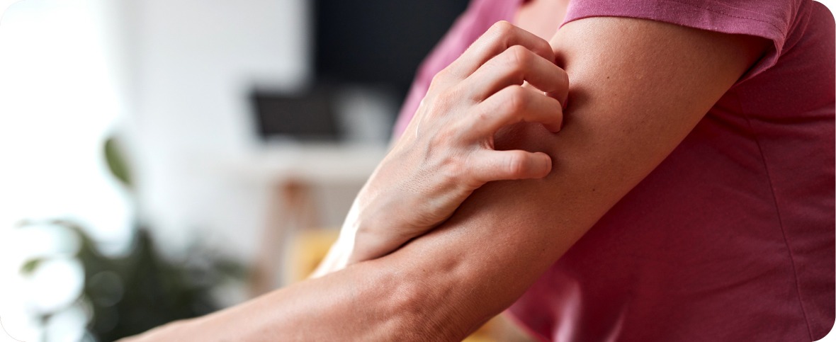 Rashes and Hives: Causes, Symptoms, and Treatment | Maple