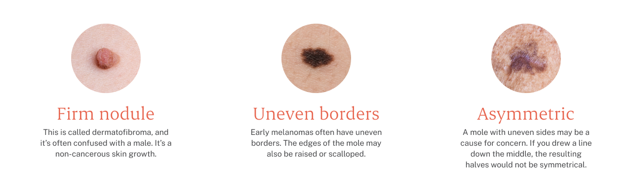 Pre Cancer Skin Spots